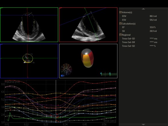 Cardiac Imaging & Non-Invasive Testing - NewYork-Presbyterian