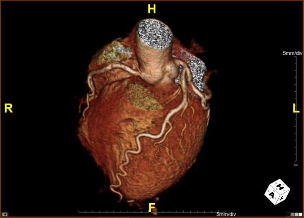 Cardiac Imaging & Non-Invasive Testing - NewYork-Presbyterian