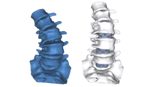 Rehabilitation Medicine: pioneers in cutting edge research for Physical ...